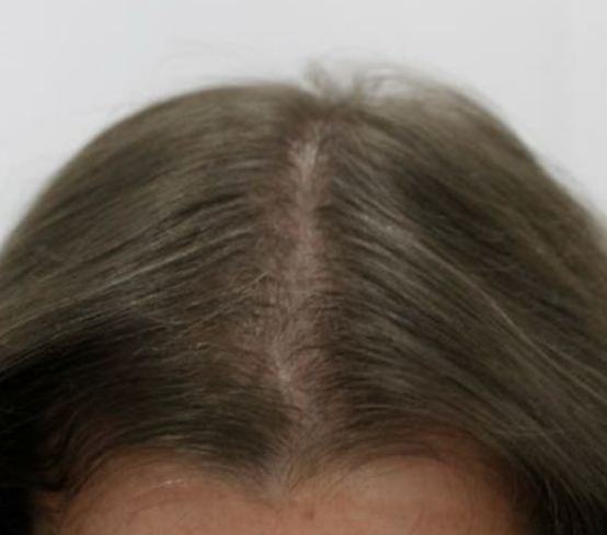 Personalized hair growth topical (60ml) - Roots