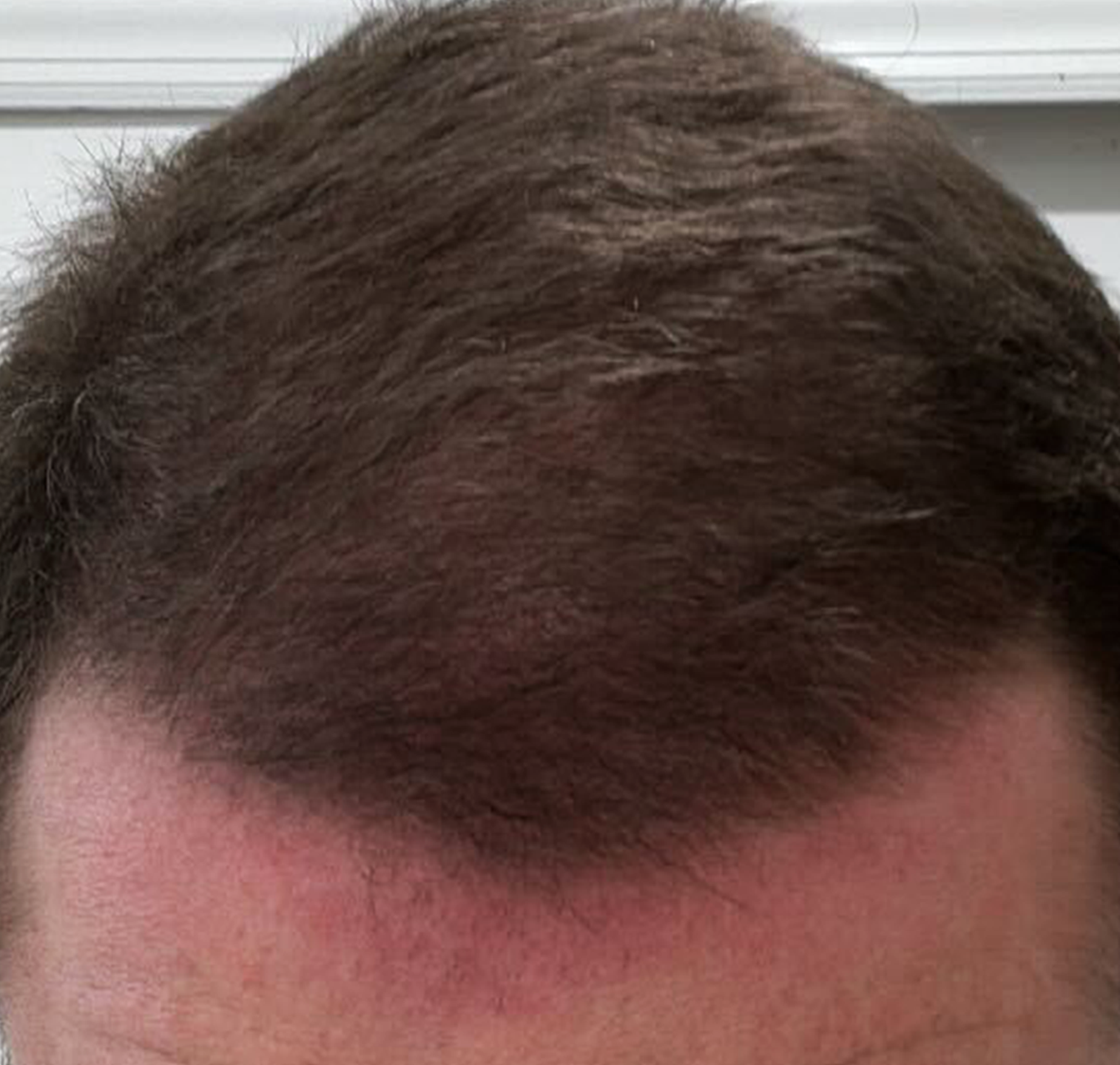 Custom Hair Growth Topical (45ml) - Roots