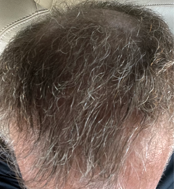 Roots By Genetic Arts - Custom Topical and Genetic Test - Roots