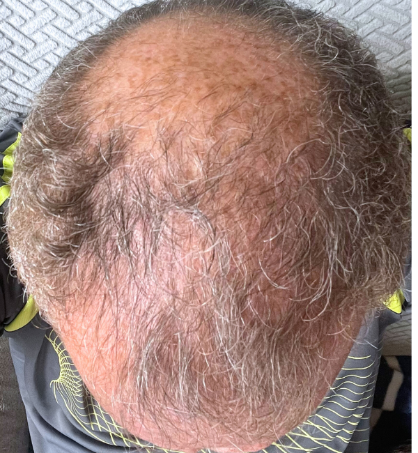 Roots By Genetic Arts - Custom Topical and Genetic Test - Roots