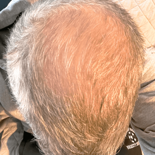 Roots By Genetic Arts - Custom Topical and Genetic Test - Roots