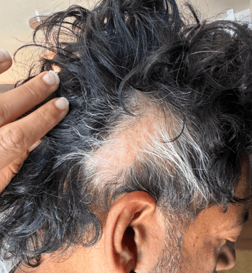 Roots By Genetic Arts - Custom Topical and Genetic Test - Roots