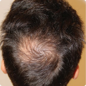 Roots By Genetic Arts - Custom Topical and Genetic Test - Roots